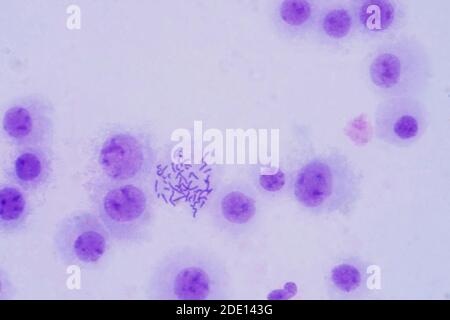 Light micrograph of mitosis (cell division) in root tip cells of garlic ...
