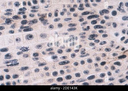 Mitosis. Light micrograph of onion (Allium cepa) root tip cells ...