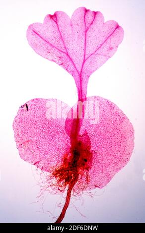 Fern prothallus with sporophyte and rhizoids. Optical microscope ...