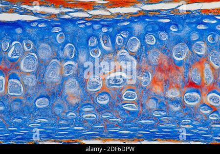 Ear section showing elastic cartilage tissue with chondrocytes. Optical ...