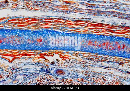 Ear section showing elastic cartilage tissue with chondrocytes. Optical ...
