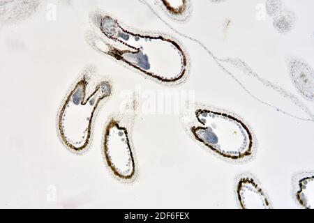 Inmature embryo of shepherd purse (Capsella bursa-pastoris). Optical ...