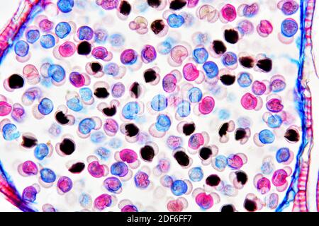 Male cone of pine (Pinus sp.) showing pollen. Optical microscope X100 ...