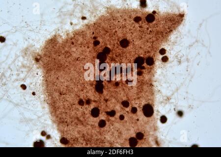 Conidia and conidiophores of fungus ascomycetes. Optical microcope X100 ...