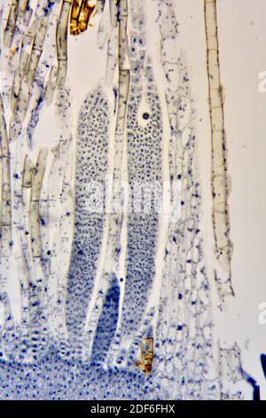 Archegonium of moss. Optical microscope X200 Stock Photo - Alamy