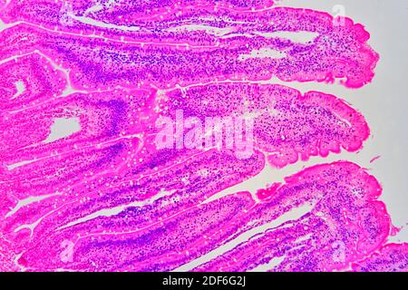 Small intestine cross section showing mucosa, submucosa, lamina propria ...