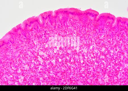 Stomach cross section showing mucosa, submucosa, muscular layer and ...