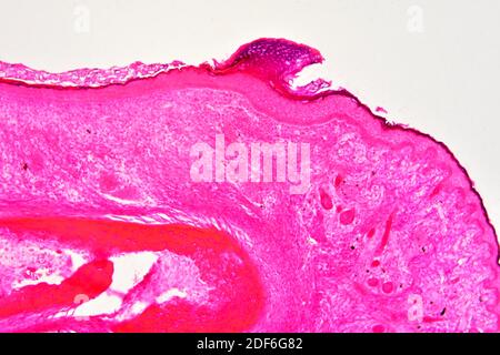 Human finger section showing epidermis (stratified squamous epithelium ...