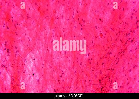 Loose connective tissue showing collagen fibers and fibroblasts ...