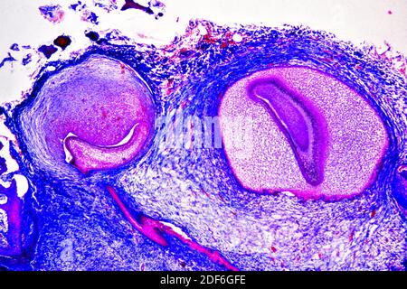 Connective tissue in a tooth in formation. Light microscope X40 at 10 ...