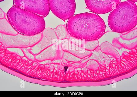 Ascaris lumbricoides female showing cuticle, epithelium, longitudinal ...