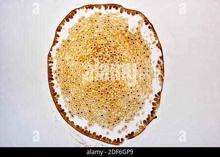 Ascaris megalocephala female, uterus with meiosis. Horse intestine ...