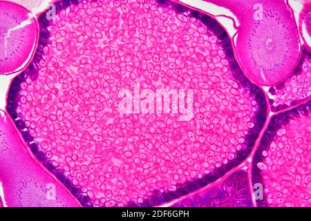 Ascaris lumbricoides female showing ovaries and uterus with eggs. Light ...