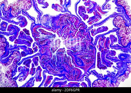 Sea anemone- (microscope Stock Photo - Alamy