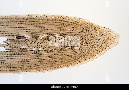 Calyptra or root cap protecting meristematic tissue of onion root ...