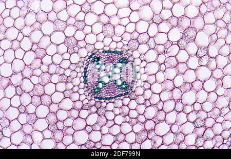 Reserve parenchyma, cross section. Ranunculus root photomicrograph ...