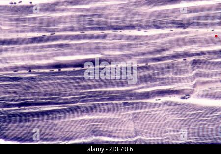 Skeletal muscle, longitudinal section. Photomicrograph Stock Photo - Alamy
