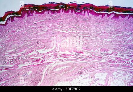 Human finger section showing epidermis (stratified squamous epithelium ...