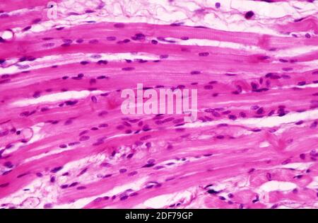 Skeletal muscle, longitudinal section. Photomicrograph Stock Photo - Alamy