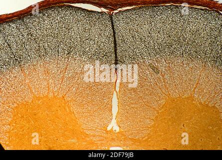 Spinal cord, anterior side showing grey and white matter ...