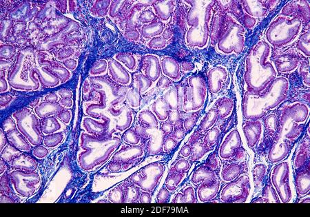 Salivary gland section showing lobules and acini. Photomicrograph Stock ...