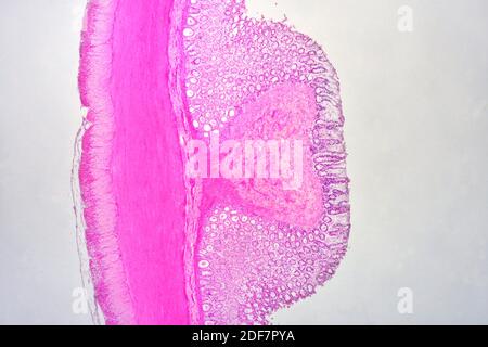 Human Appendix cross section showing simple columnar epithelium. LM ...