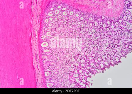 Human Appendix cross section showing simple columnar epithelium. LM ...