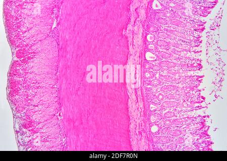 Human Appendix cross section showing simple columnar epithelium. LM ...