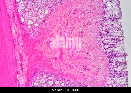 Human Appendix cross section showing simple columnar epithelium. LM ...