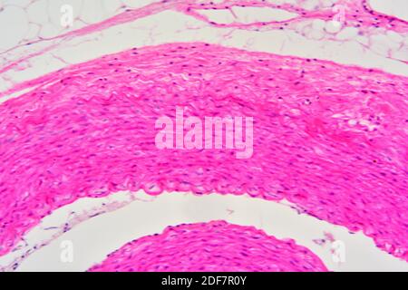 Light microscope micrograph showing the tunica albuginea of a human ...