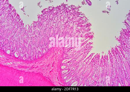 Human Appendix cross section showing simple columnar epithelium. LM ...