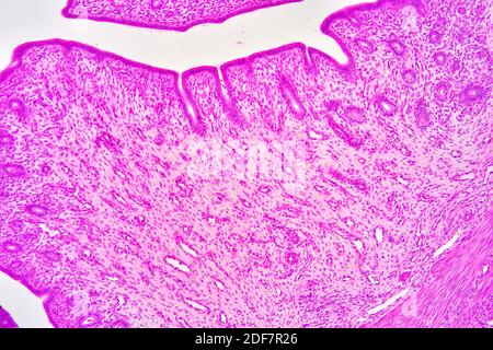 Human cervix. Light micrograph of a section through the epithelium of a ...