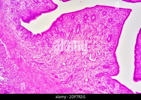 Human cervix. Light micrograph of a section through the epithelium of a ...