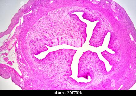 Human cervix. Light micrograph of a section through the epithelium of a ...