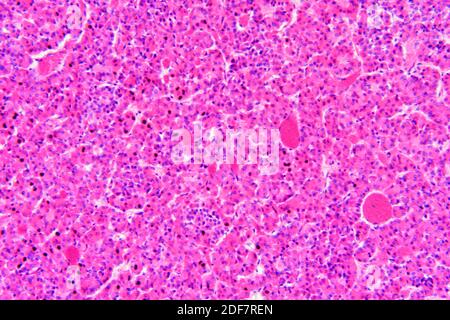 Pituitary gland. Light micrograph of a section through the anterior ...