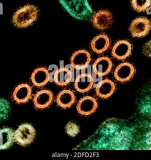 Influenza B virus particles, colorized orange and pink, isolated from a ...