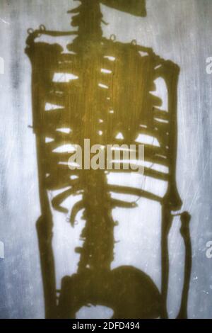 Shadow of a human skeleton Stock Photo - Alamy