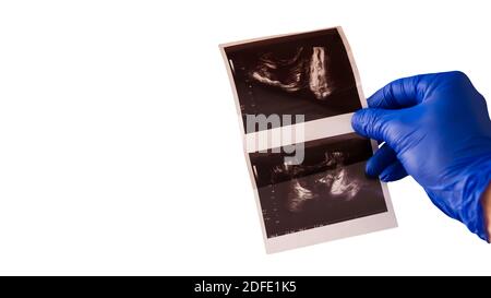 Doctor demonstrates an X-ray of the male prostate gland, to diagnose ...