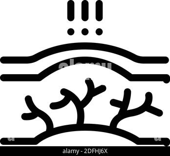 varicose veins icon black vector illustration Stock Vector Image & Art ...