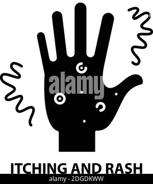 Woman scratching skin. Girl with itching elbow hand or rash on body ...