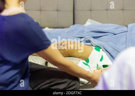 Metal staples used to stitch up skin in knee replacement operation ...