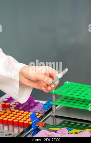scientist prepare blood sample for research on microscope. Placing ...