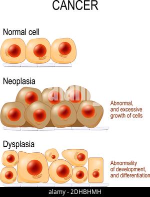 Proliferation of Healthy Cells and Cancer Cells. Comparison ...