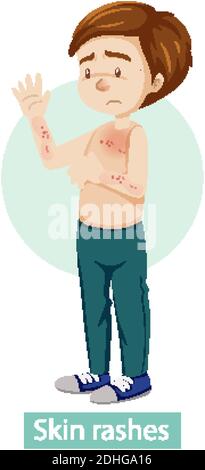 Cartoon character with skin rashes symptoms illustration Stock Vector ...