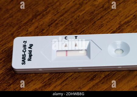 Negative antigen test Stock Photo - Alamy