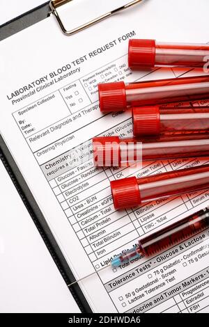 Clipboard with paper blank form with blood test tubes on white ...
