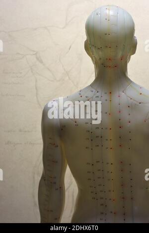 acupuncture therapy on back spine shoulders for black client. cropped ...