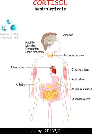 Cortisol. Health effects of hormone adrenal gland. increased and ...