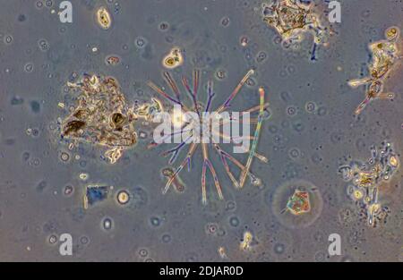 Bacteriastrum diatom, Hong Kong, China Stock Photo - Alamy