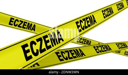 Eczema. Yellow warning tapes with black words ECZEMA (eczema is a group ...